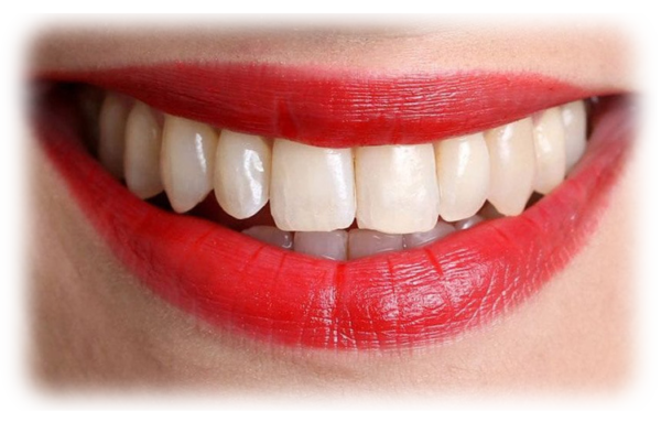 Cosmetic Smile Design Miami Springs - Smile Makeover Hialeah